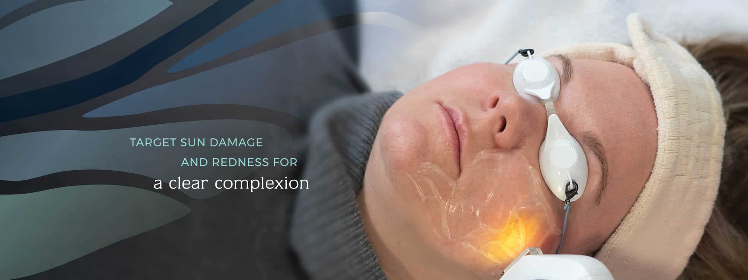 BBL • RN Esthetics • Skin Health & Wellness: Salem · Lynnfield ...