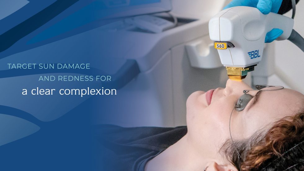 BBL • RN Esthetics • Skin Health & Wellness: Salem · Lynnfield ...